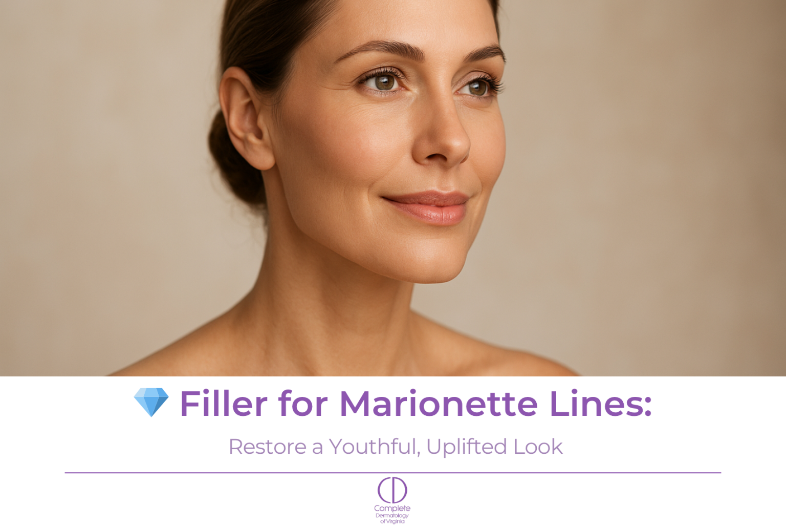 💎 Filler for Marionette Lines: Restore a Youthful, Uplifted Look ...